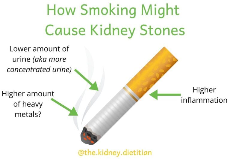 Does Smoking Cause Kidney Stones? [from a kidney stone dietitian] - The ...